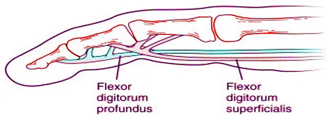 My rogue pinky: lessons in gratitude, music, my gifts, and kitchen safety